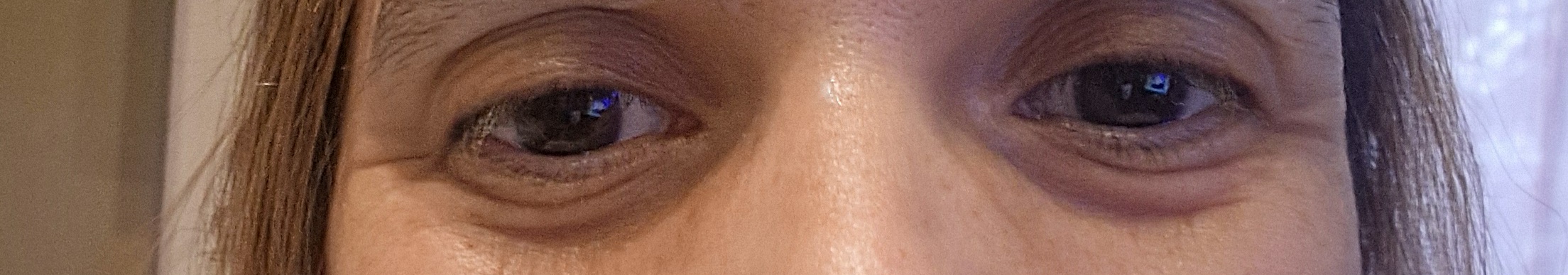EYE CRYO LIFT - The Lifting Eye Serum - Kallist Cosmetics