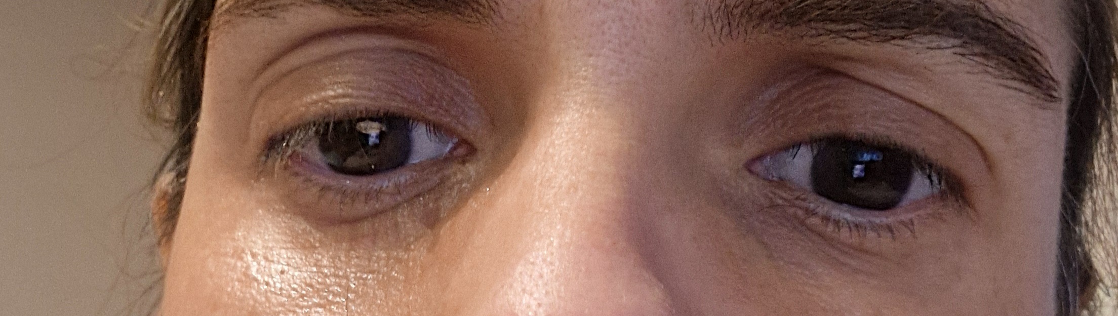 EYE CRYO LIFT - The Lifting Eye Serum - Kallist Cosmetics